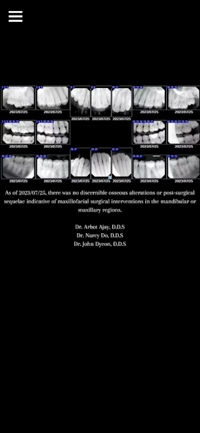 SyrianPsycho’s X-RAY - Syrian Psycho